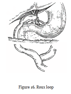 Liver Transplantation - Dr Faisal Dar