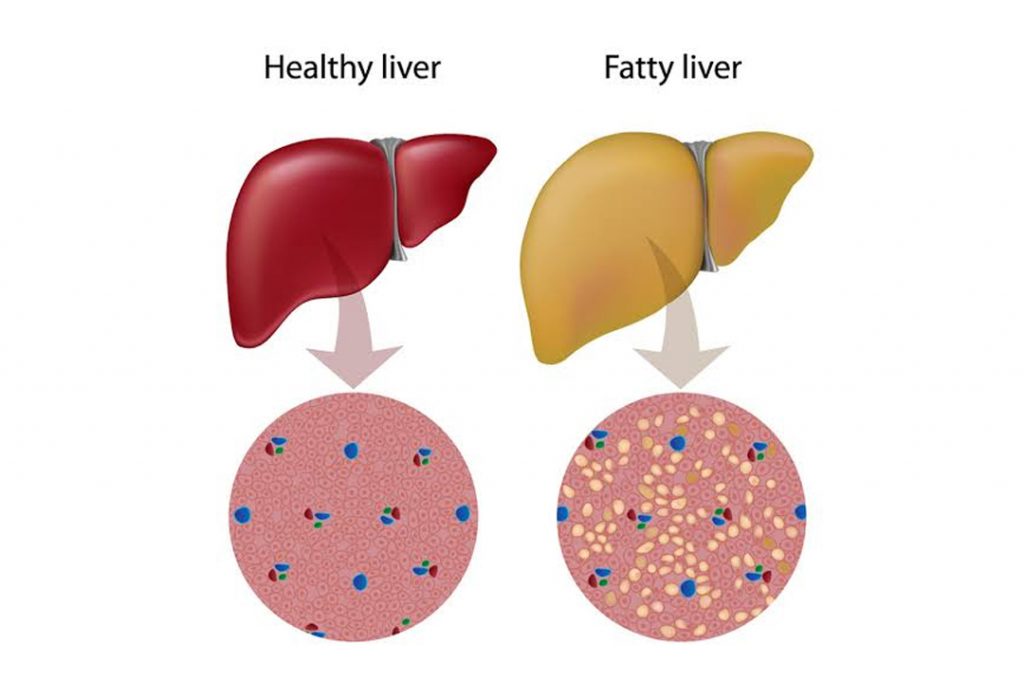 Fasting and Liver, A Miracle – Dr Faisal Dar