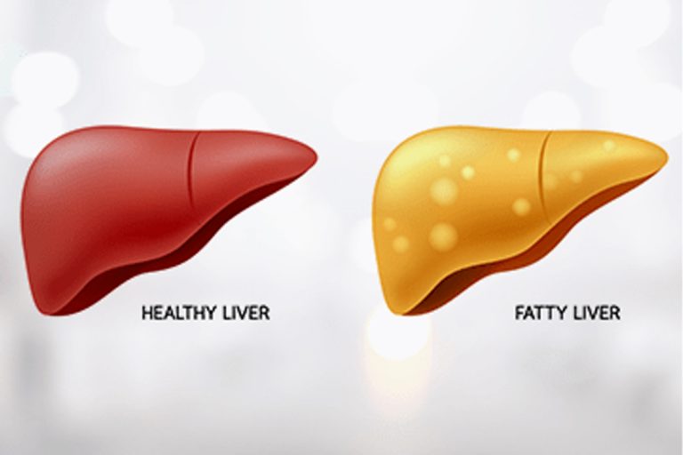 Unhealthy Liver & It’s Symptoms – Dr Faisal Dar
